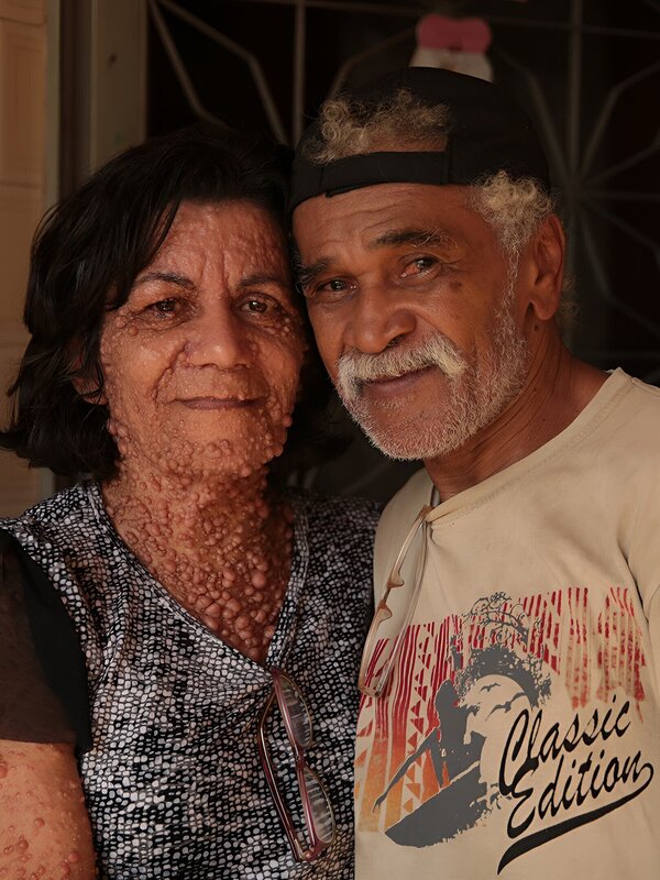 Body Bizarre – Unglaubliche Schicksale S05E03: Folge 3 (My Son Has ...