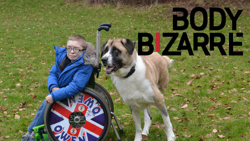 Body Bizarre – Unglaubliche Schicksale S06E07: Folge 7 (Boy With No ...