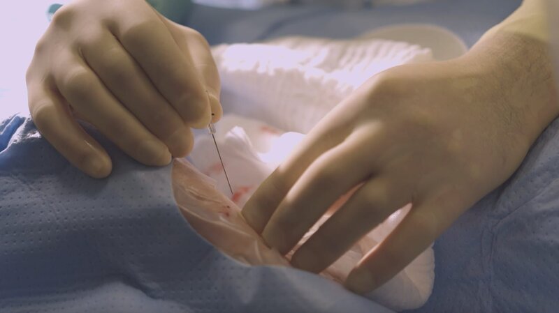 plan b (2017) 305: Jede Minute zählt: Schnellere Hilfe bei Herznotfällen – fernsehserien.de